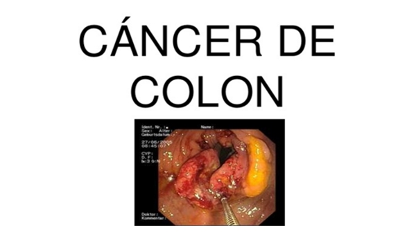 Medicina III - Cáncer de Colon | USMP FN Archivos