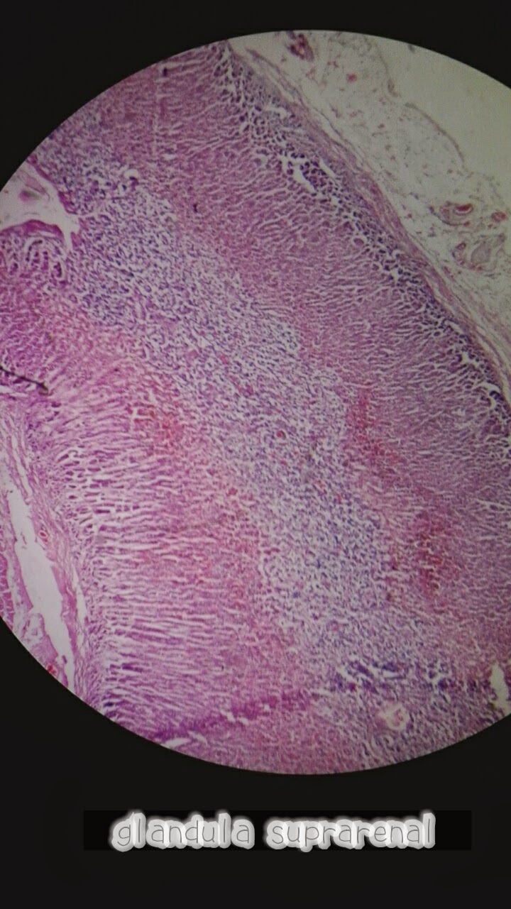 Placas De Histología Glándula Suprarrenal