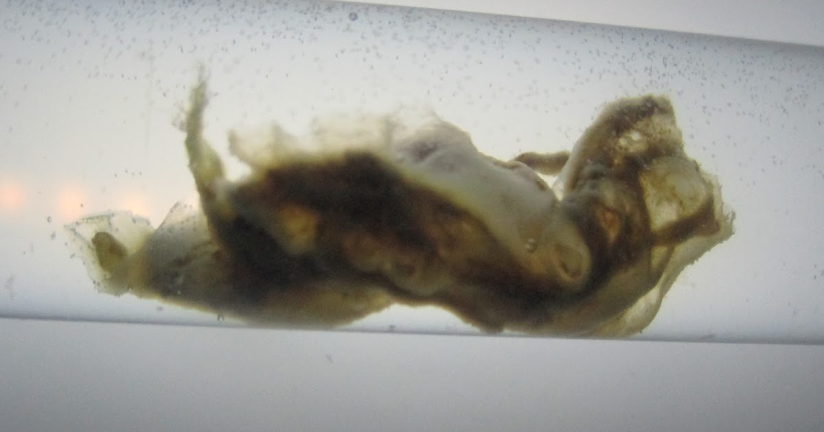 The Parasite Gallery: Colon Cleanse