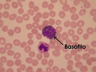 fichero de Hematologia
