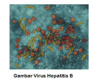 BIOLOGI ITU SERU!: KELAINAN PADA HATI