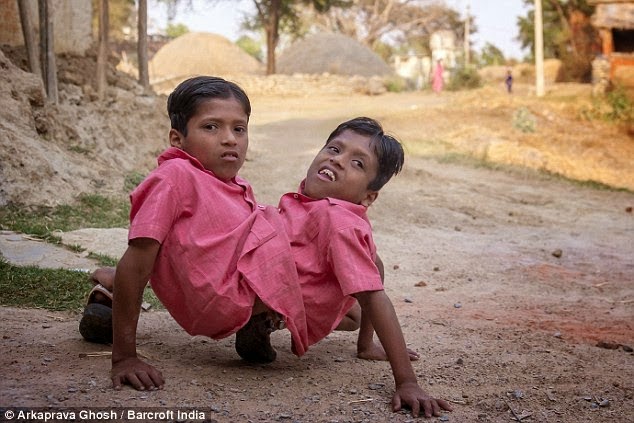 HABARI DAY: PICHA ZA WATOTO WAWILI MAPACHA WALIOFANANA…!!