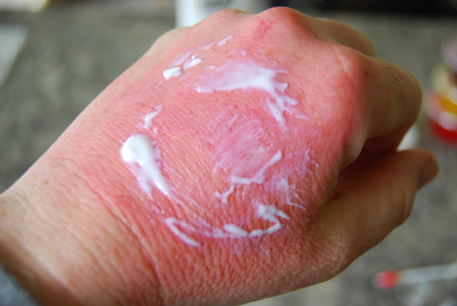 Ole Mother Hubbard: CAS-SIM Casualty Simulation. Wet look burn TUTORIAL.