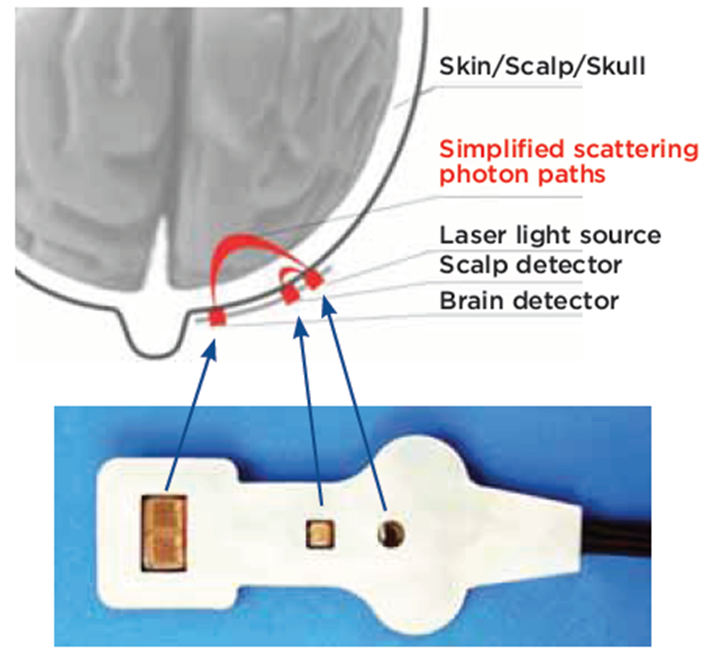 台北慈濟醫院麻醉科: 新儀器rSO2來囉！