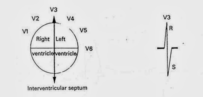 dokter-medis: Menentukan Sumbu Jantung Secara Cepat