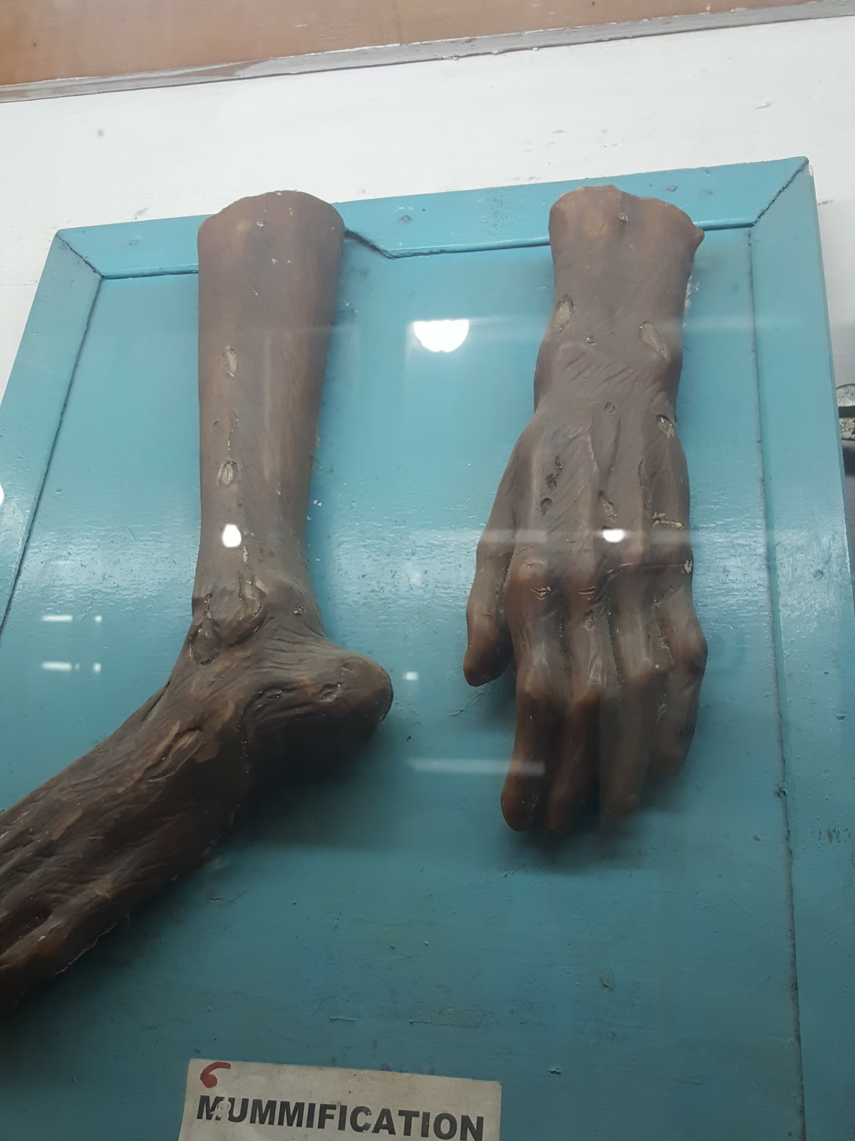 Forensic museum models and specimens (upadated 2016)