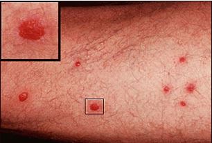 Uidumõtteid ja juhtumisi: Huatulco Needus 5 - Parasiidid, putukad ...