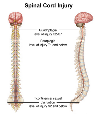 Spinal Cord Injury Causes , Symptoms ,Diagnosis and Treatment: C1-C7 ...