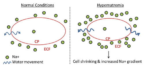 Hypernatremia - Definition, Symptoms, Causes, Correction, Treatment