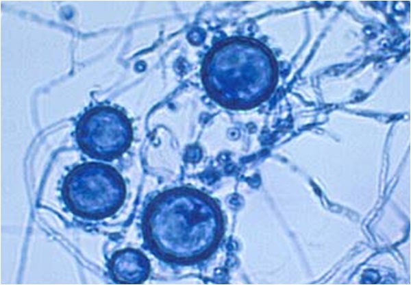 Lecture Notes In Medical Technology Lecture 16 Introduction To Mycology