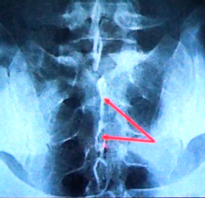 RADIOANATOMIA: CLASE 9