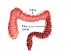 Prof. Dr. Ulysses Fagundes Neto - Gastroenterologia Pediátrica e ...