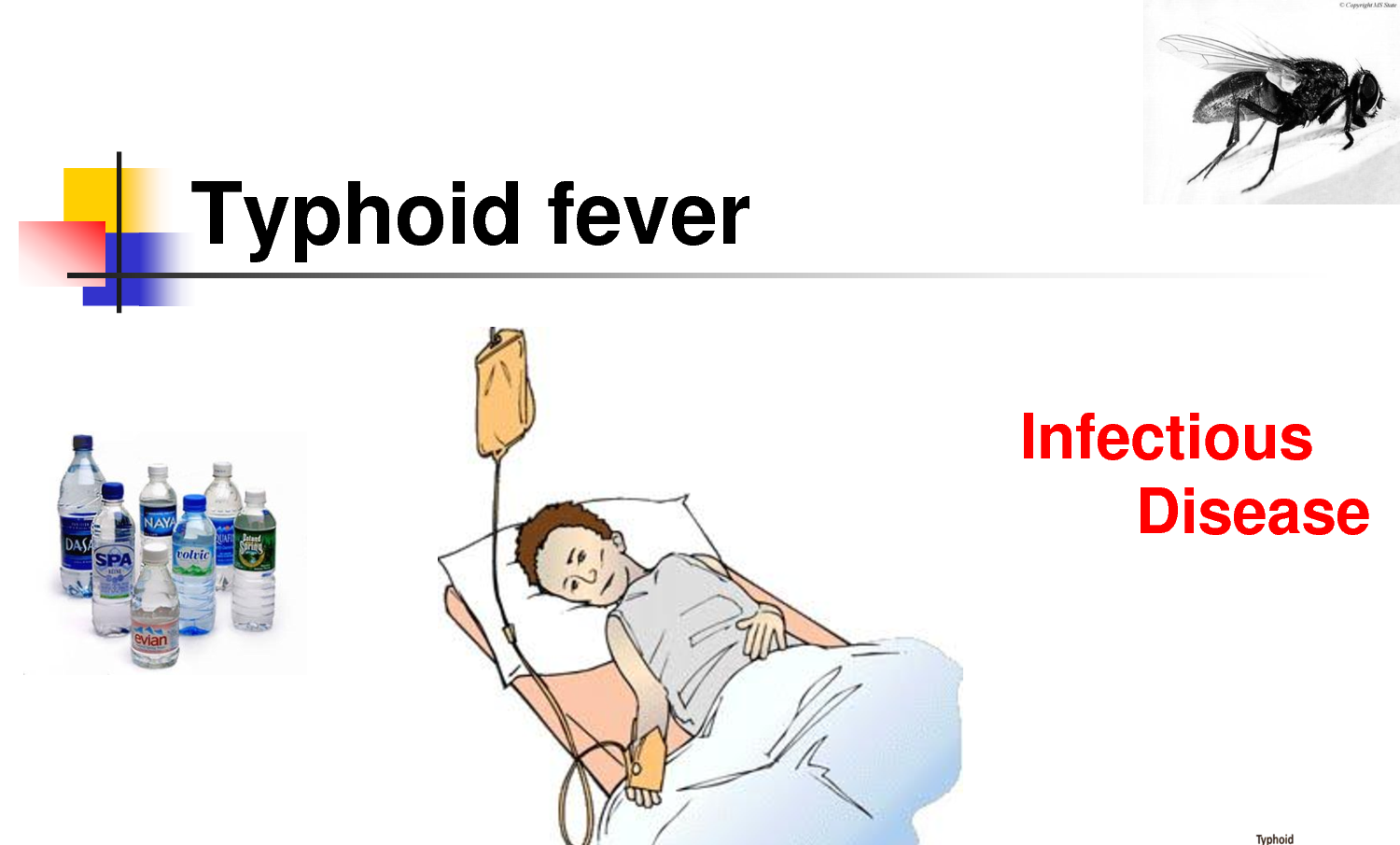 Apa Itu Demam Kepialu (Tifoid)
