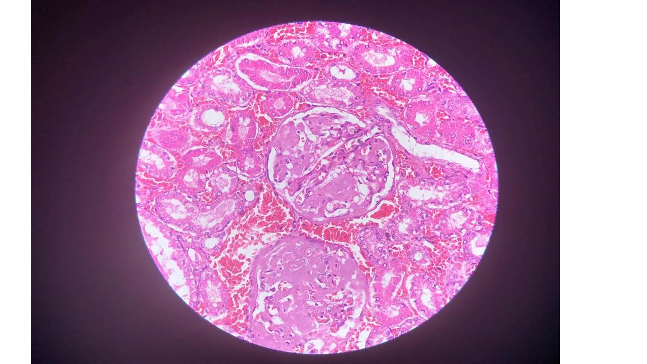 HISTOLOGIA90: RIM NORMAL E GLOMERULONEFRITES