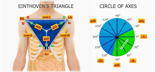Cardiac Axis in Right and Left Bundle Branch Block