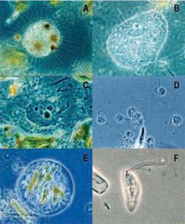 El Reino Prokaryotae y El Reino Protista | Explorando el Universo de la ...