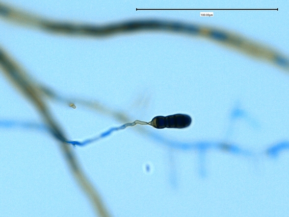 Fun With Microbiology (What's Buggin' You?): July 2015