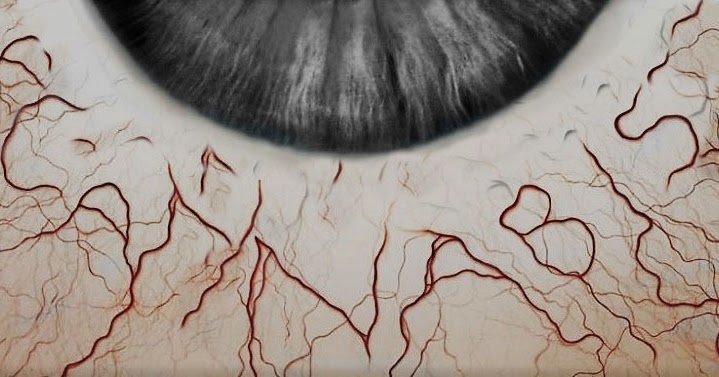 OJO ALÉRGICO, SECO GRAVE Y SJÖGREN: CANNABIS Y OJOS ROJOS