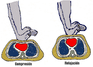 Vida de Enfermería: Técnica RCP.