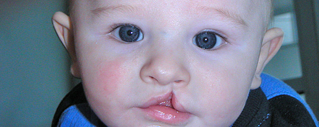 Hablemos de Fonoaudiologia: Estomatología