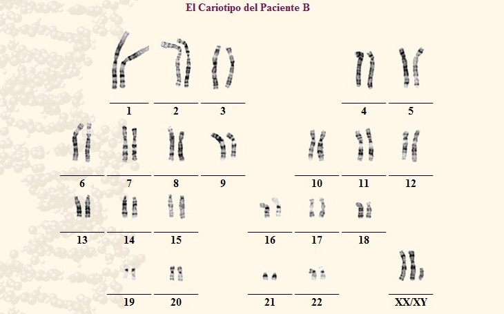 BIOMÈDICS GARBÍ: CASOS MÈDICS AMB CARIOTIPS