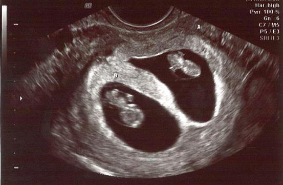 In this JOYFUL life: Watch us grow...