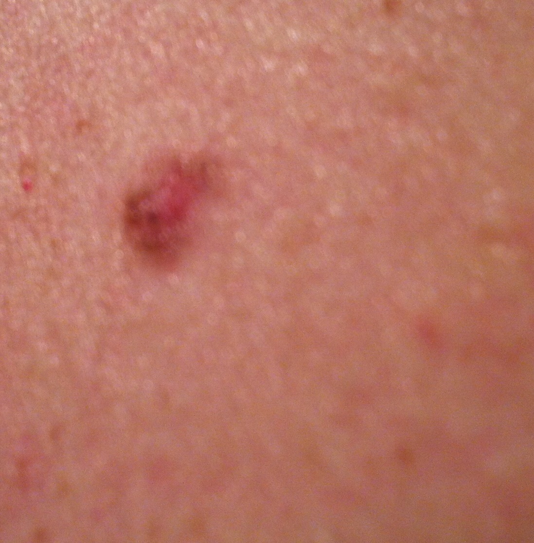 A Life Less Ordinary...: Dermatology For Dummies