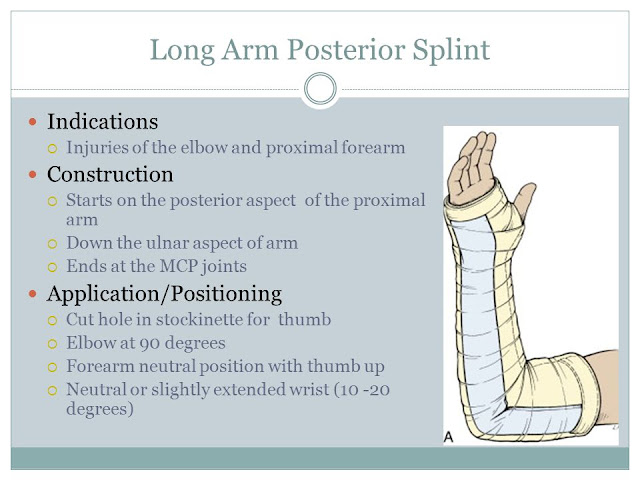 Long Arm Posterior Splint