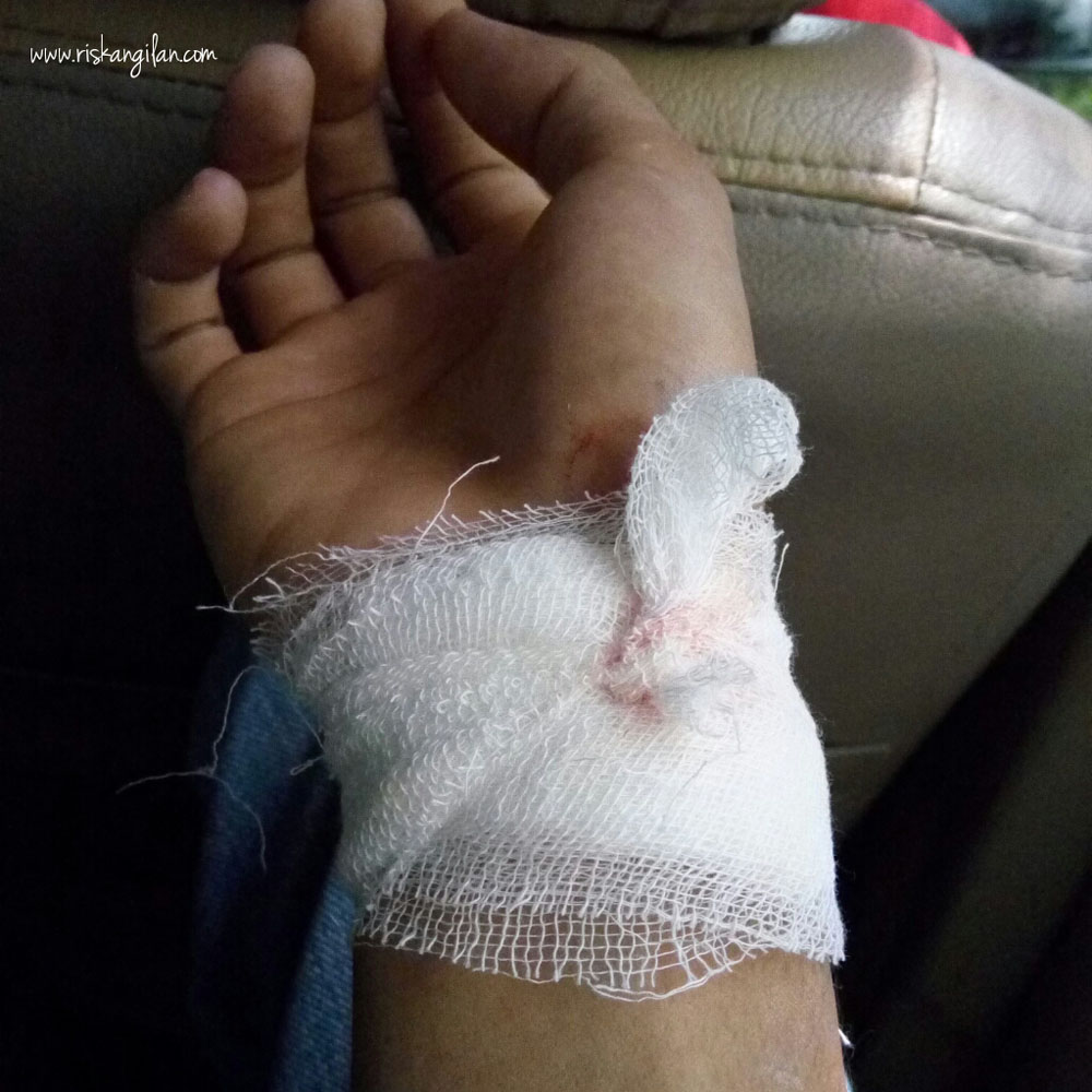 Pemulihan Kondisi Tubuh Pasca Operasi Ganglion - Riska Ngilan
