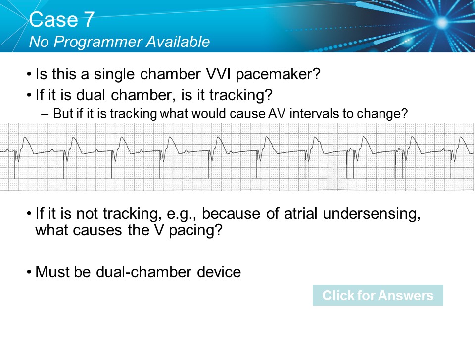CVT Mohd Farid: Basic Pacemaker Troubleshooting Part II-Medtronic Academy