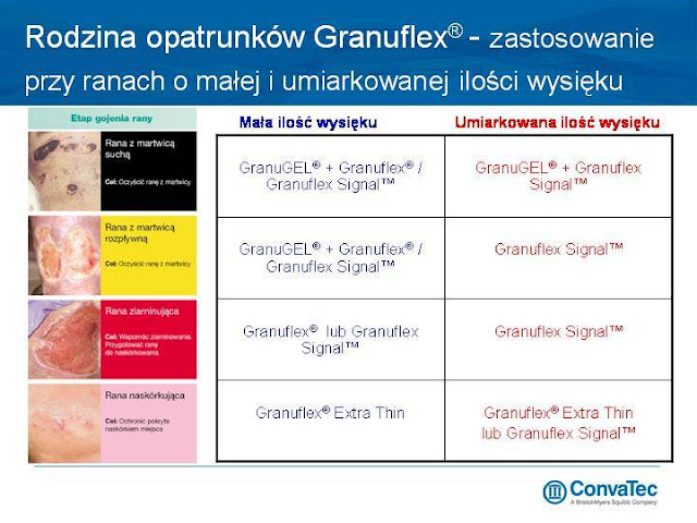 Leczenie Ran Przewlekłych - pomoc dla pacjentów i personelu medycznego ...