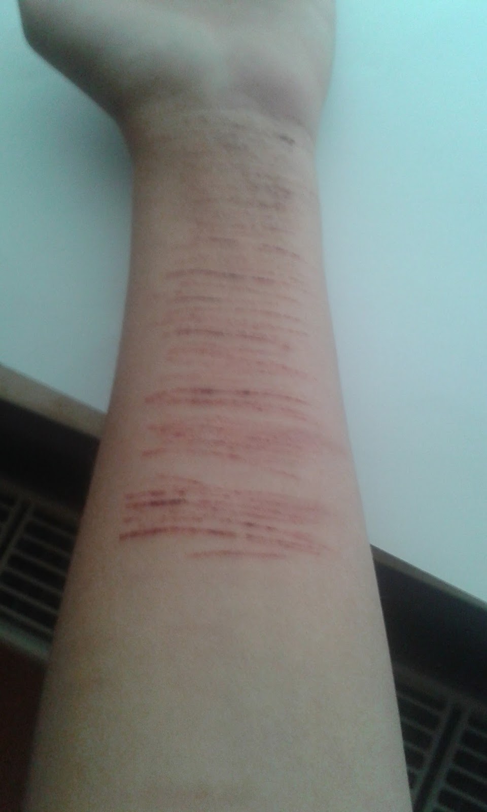 D-Boy: Samookaleczanie i moja depresja