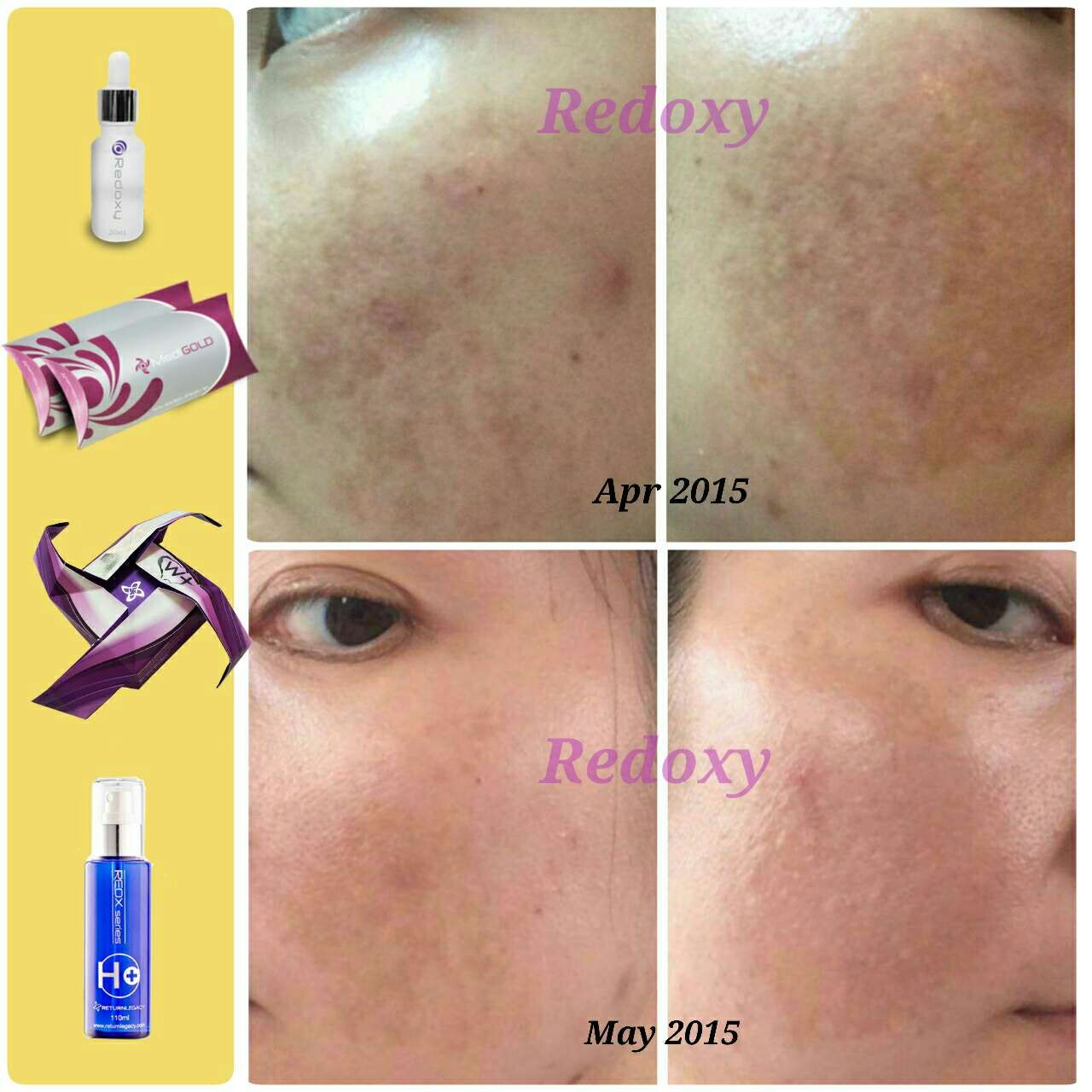 Malaysia Return Legacy Products(reviewed/explained)- Redoxy, Medigold ...