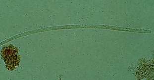 Variety of Life: Onchocercidae