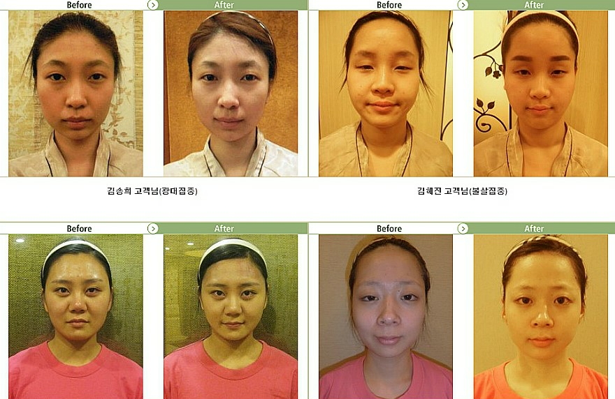 Face Meridian Massage, Natural Facelift Massage, Facelift Reflexology