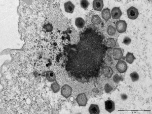 חיידקים, נגיפים, ושאר "ירקות" - בלוג של ביולוג - ד"ר דרור בר-ניר: נגיף ...