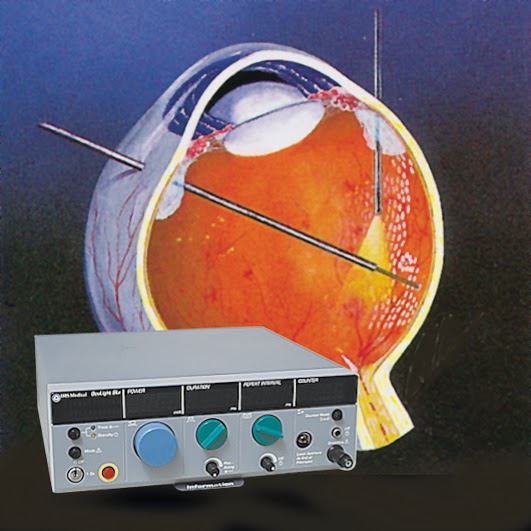 Cirugía de la Retina y del Vítreo - Centro de Oftalmología Bonafonte
