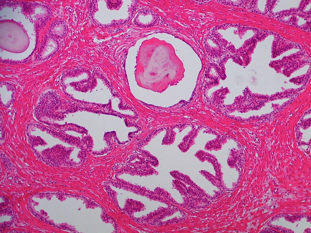 SOS BIOLOGIA CELULAR Y TISULAR: GENITAL MASCULINO. ¿QUE GLANDULA ES?