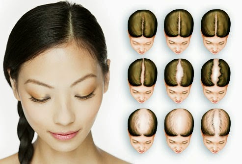 6 Tips Elak Rambut Gugur Bagi Wanita Bertudung - Bakul2011.com