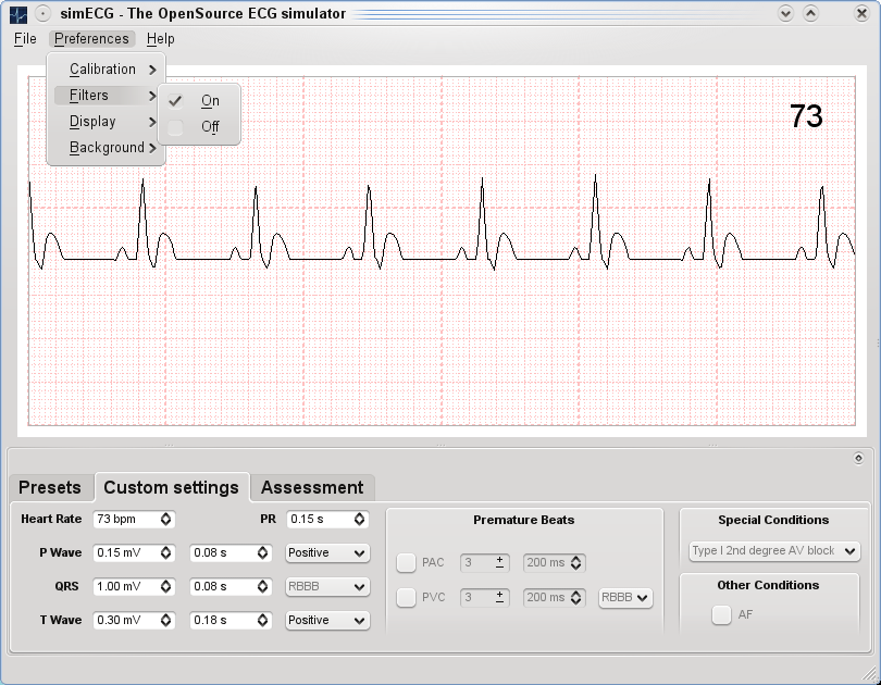 Blog De todo: SIMULADORES DE ELECTROCARDIOGRAMA