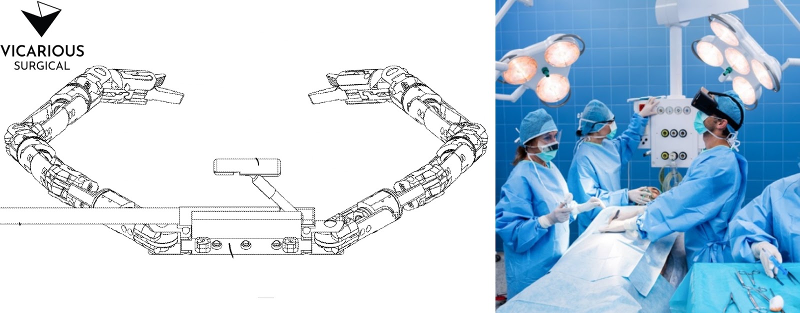 Vicarious Surgical--VR meets surgery