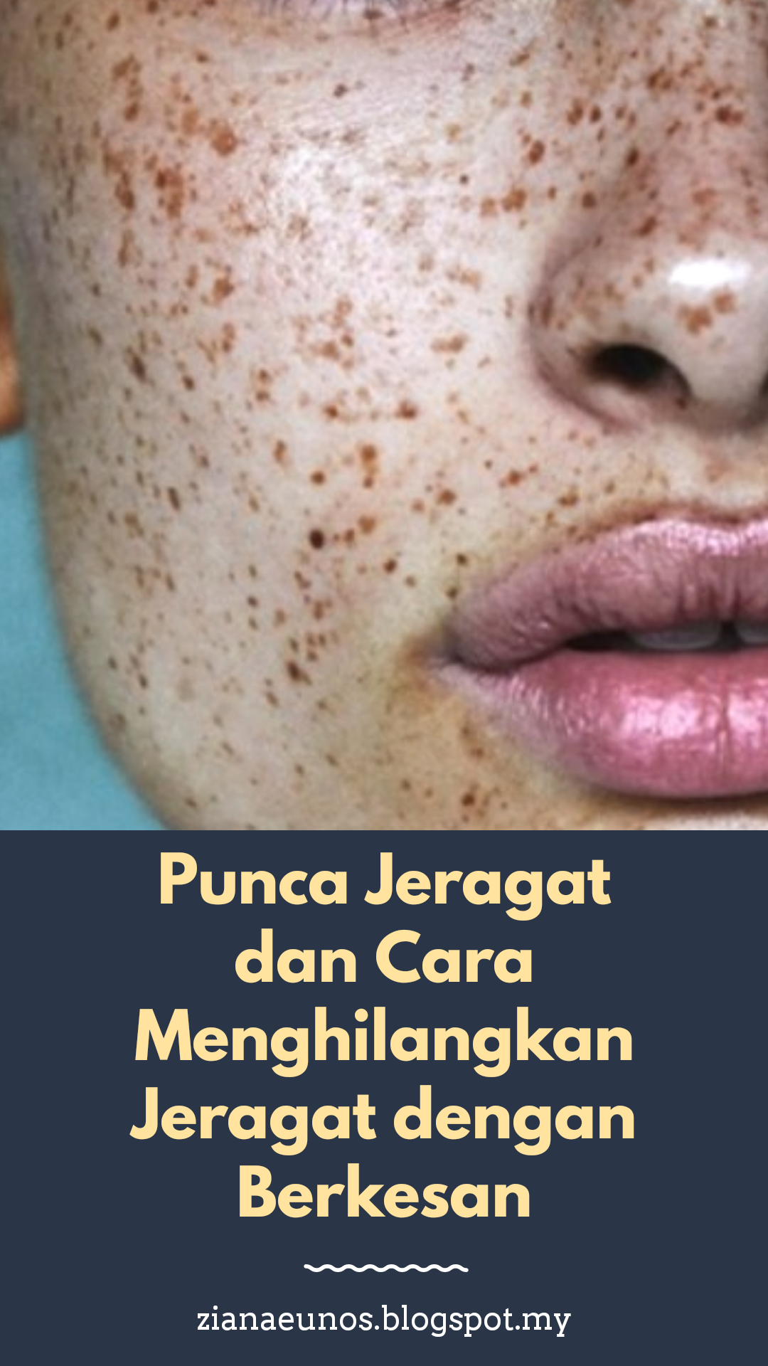 Punca Jeragat dan Cara Menghilangkan Jeragat dengan Berkesan