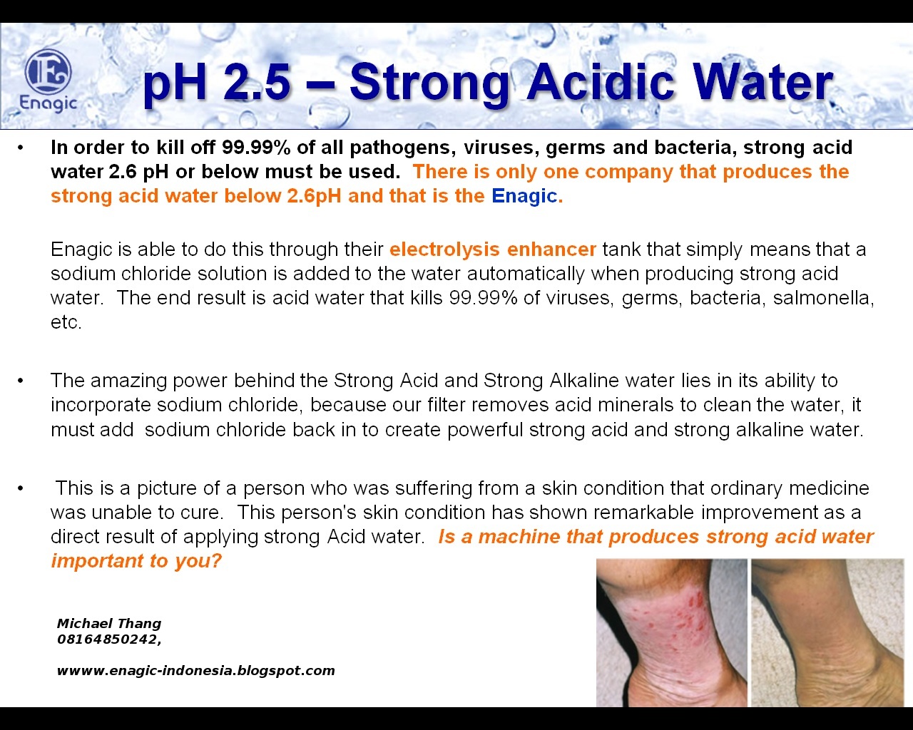 Testimoni | STRONG ACIDIC WATER | Kangen Water