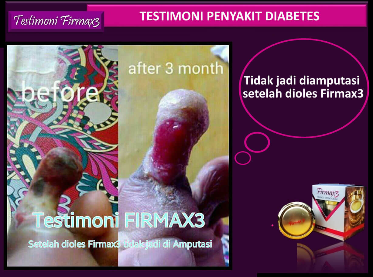 Testimoni dan Cara Pemakaian Firmax3 Untuk Diabetes