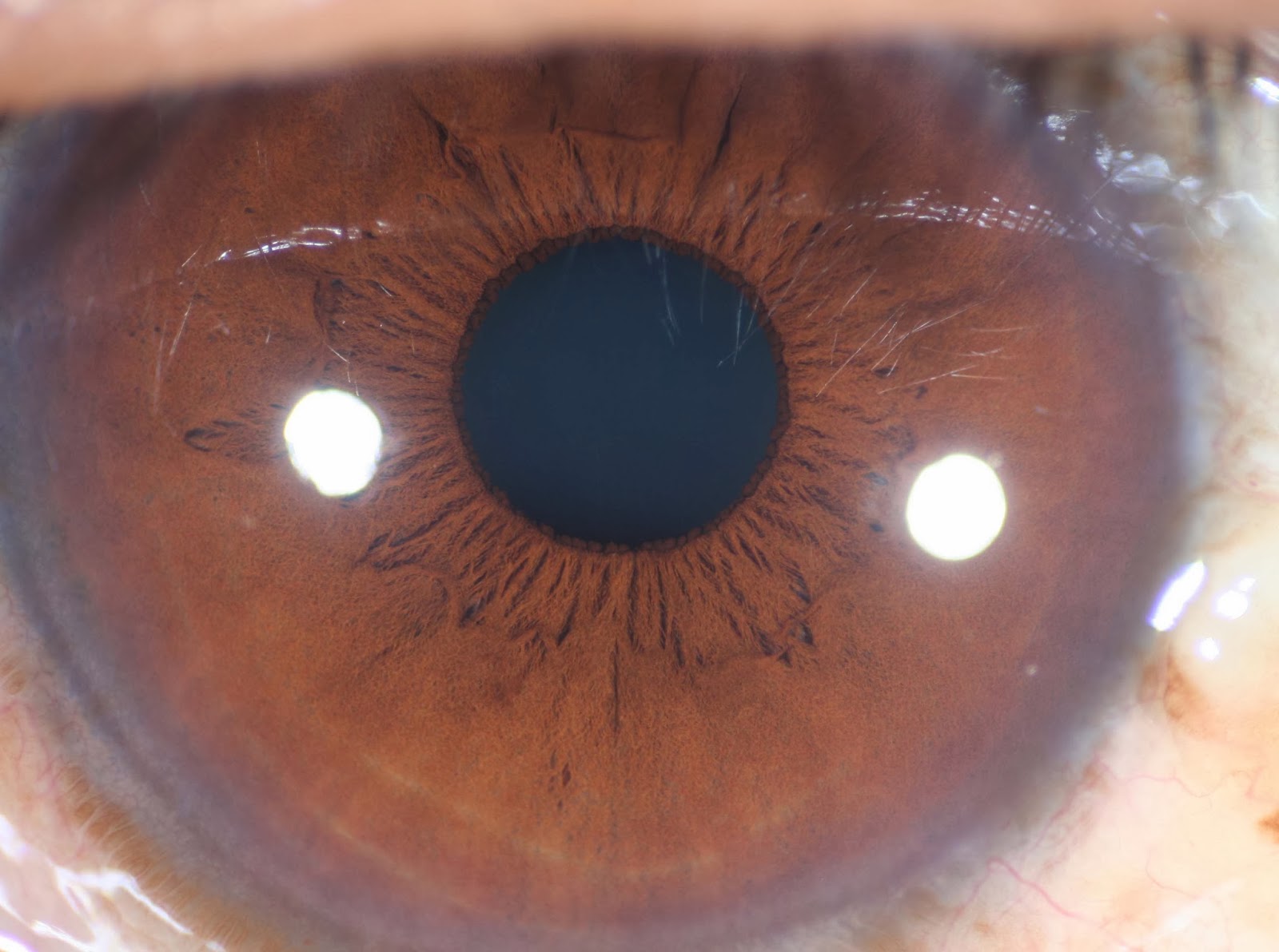 Modern & Multidimensional Iridology: IPB Morphologies, Pupil ...