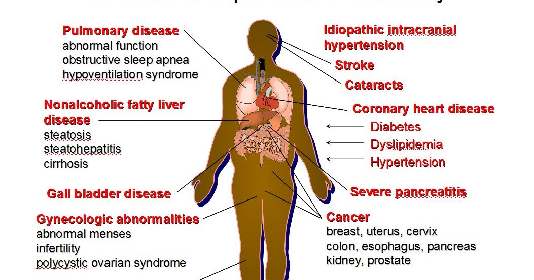 Get Fit Get Happy Forever: Obesity - Is it a Disease?