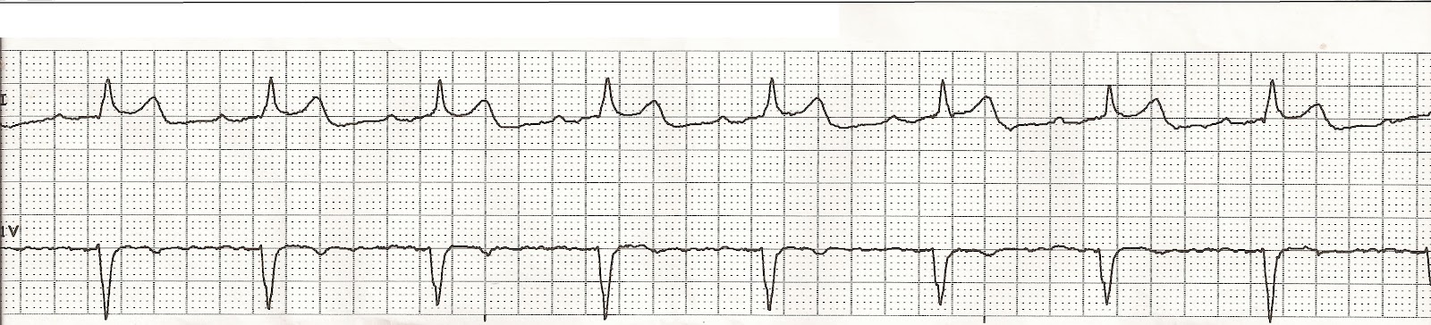 EKG Rhythm Strip Quiz 48