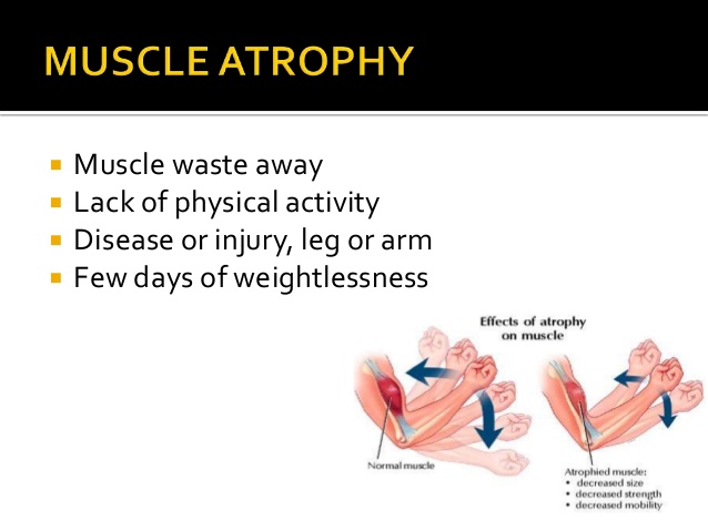 Transformed Fitness: Muscle Atrophy! What Is It?