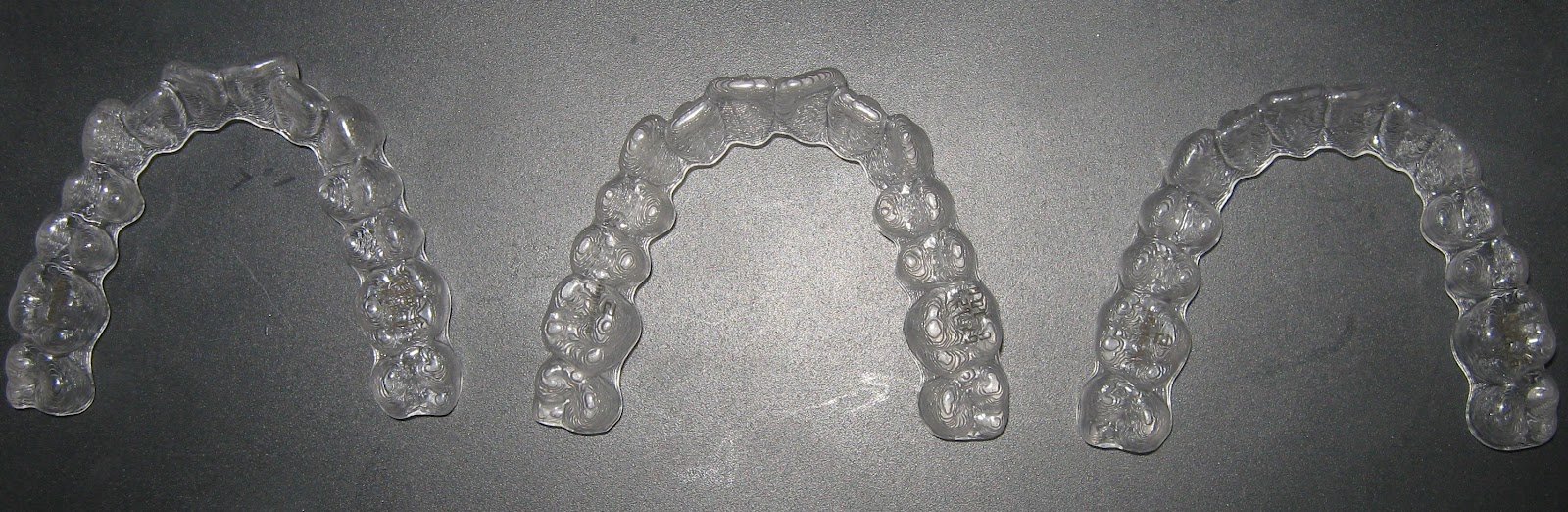 Br@ndy's Invisalign Journey: Tray 20!
