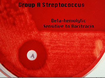 Bacitracin Test - Microbiology Laboratory Turkey